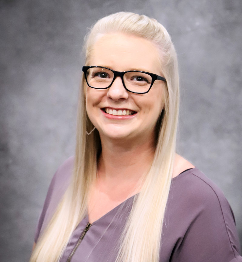 Fontaine Fifth Wheel -- Heavy Duty and Weight Savings No-Slack Fifth Wheels